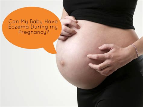 Eczema Flare Up During Pregnancy And Its Diagnosis