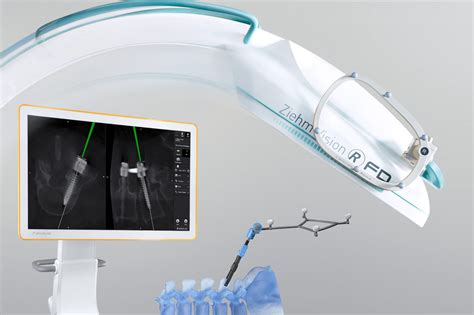 Spinal Navigation Digitalizing Spine Surgery Brainlab