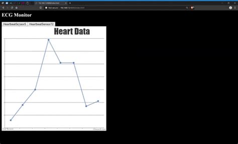 GitHub Dtsiedel ECGMonitor An ECG Monitor That You Can View In The Browser