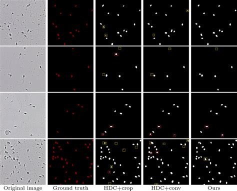 Comparison Of HDC Crop HDC Conv And Ours Download Scientific Diagram
