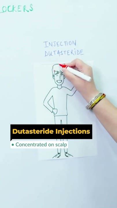 Finasteride And Dutasteride Tablet Vs Injection Whats Better 🤔💊💉