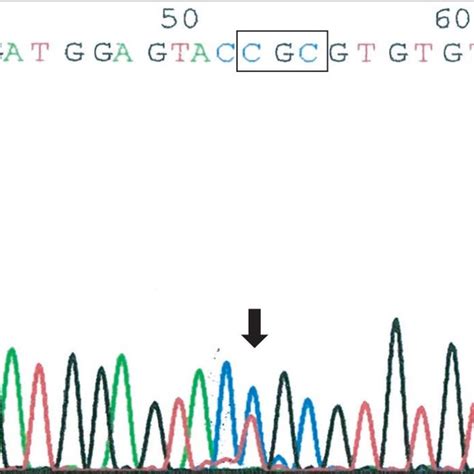 Dna Sequencing Analysis Reveals A Frame Shift Mutation Of Codon 132 Download Scientific Diagram