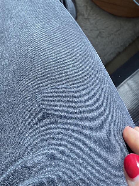 Best Freestyle Libre Images On Pholder Freestylelibre Diabetes And Diabetes T