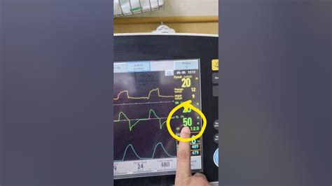How To Check The Fio2 Set In Ventilator And How Much Your Patient Is