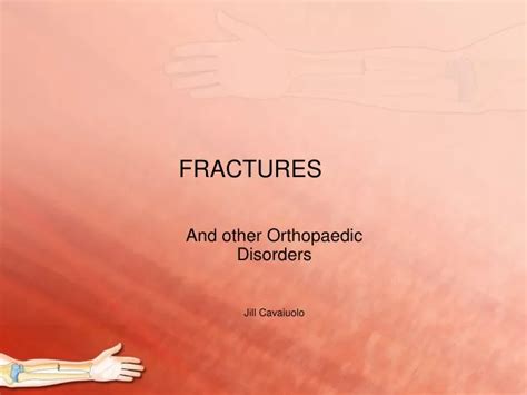 Ppt Fractures Powerpoint Presentation Free Download Id 9719153