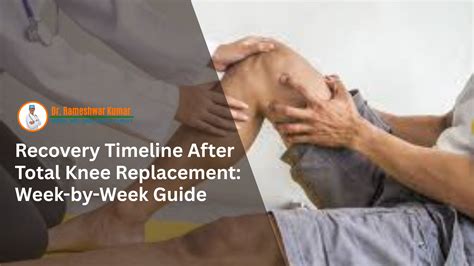 Recovery Timeline After Total Knee Replacement Week By Week Guide Dr