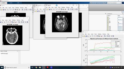 Medical Image Fusion Via Convolutional Sparsity Based Morphological