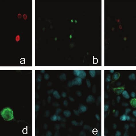 Membrane Localization Of The Mtlr9 In Sf9 Insect Cells And Hek293