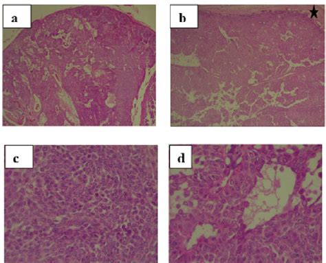 Porome Folliculaire Coloration Hématéine éosine A Et B G40