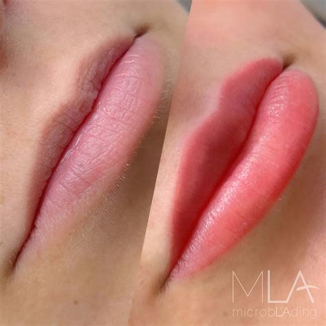 Scalp Pigmentation Cosmotekmasterclass