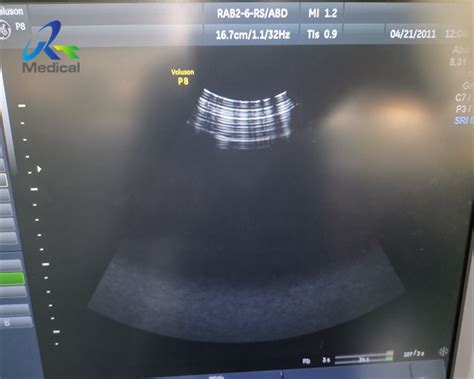 Ge Rab2 6 Rs Ultrasound Transducer Crystal Array Replacement 4d And
