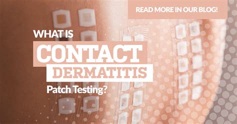 What Is Contact Dermatitis Patch Testing Texas Dermatology