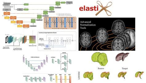 Deep Learning In Medical Image Registration Magic Or Mirage PICSL