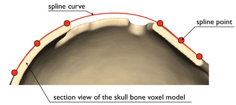 The Section View Of Skull Bone Voxel Model And The Exemplary Surface