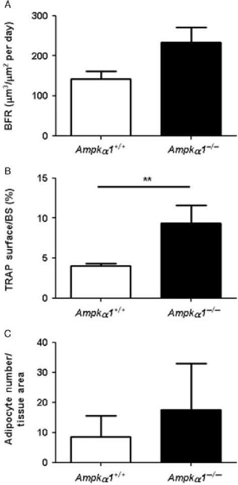 Dynamic Bone Histomorphometry Analyses In Ampka1 Cc And Ampka1 Kk