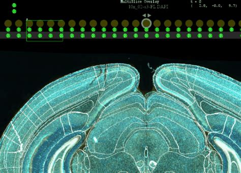 Slices Selection And Display — Abba Documentation 09 Documentation