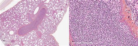 Pathology Of Pulmonary Parenchyma Of Patient 2 A Overview Of The Lung Download Scientific