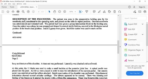 What Is The Option To Capture Multiple Page Content In IQBot Community