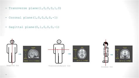 Image Registration By Using Simpleitk Pptx