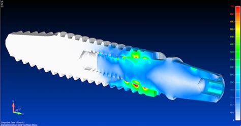 finite element analysis of the cm group stress accumulation is