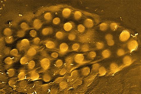 Hzi Neuer Wirkstoff Hemmt Staphylococcus Aureus Toxin