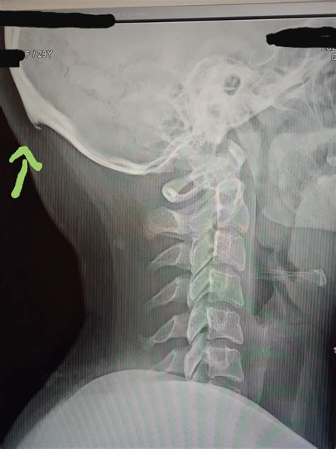 What Is This R XRayPorn