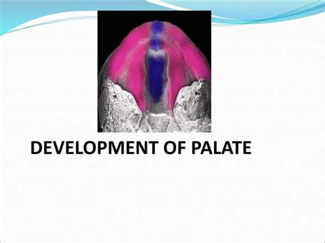 Development Of Palateppt