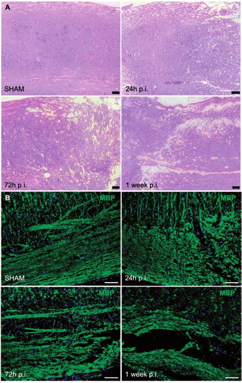 Sci Induced Disruption Of Tissue Organization A Series Of