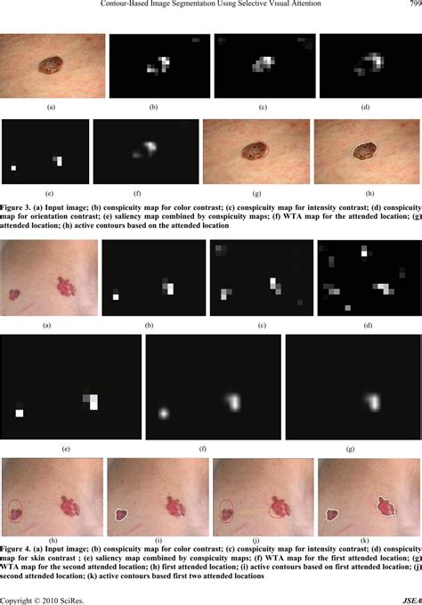 Contour Based Image Segmentation Using Selective Visual Attention