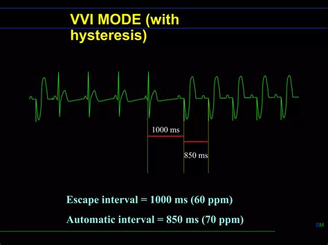 Basic Pacing Concepts PPT