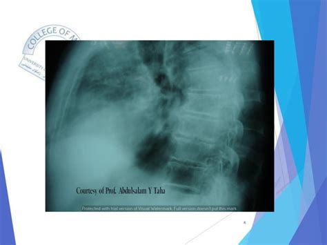 Radiology Of Thoracic Aortic Aneurysms Pdf