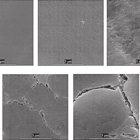 Microstructure Of Glass Ceramics With Different Content Of P 2 O 5 Download Scientific Diagram