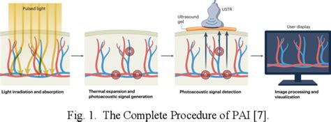 Advances In Photoacoustic Imaging Reconstruction And Quantitative Analysis For Biomedical