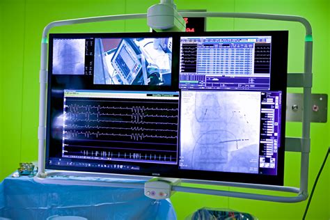 Implantable Loop Recorder AF ABLATION