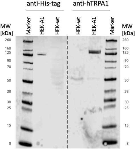 Western Blot Analysis Of Hek A1 And Hek Wt Cell Lysates Anti His Tag