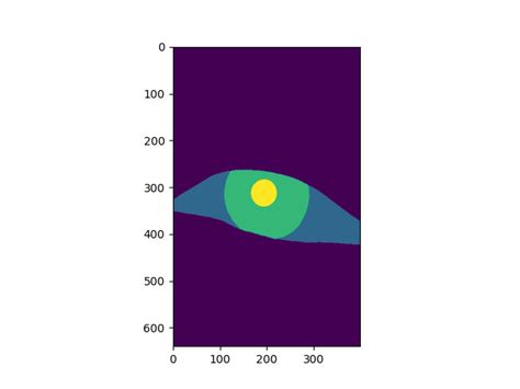 Github Aswalieye Segmentation