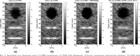 Figure 5 From Benefits Of Minimum Variance Beamforming In Medical
