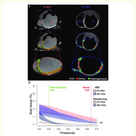 Myocardial And Scar Segmentation Process A Sample Case Of Myocardial Download Scientific