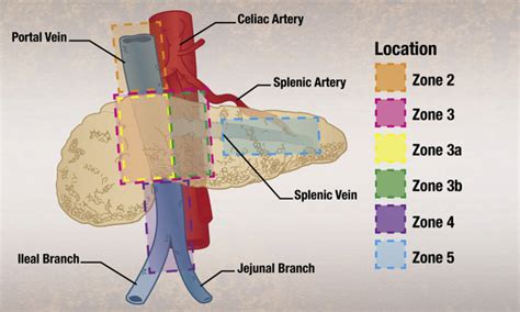 Classification And Techniques Of En Bloc Venous Reconstruction For