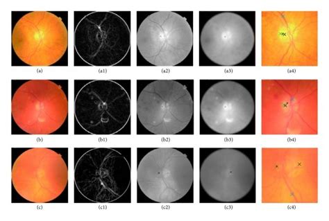 ODP Determination A B And C Original Images A1 B1 Download Scientific
