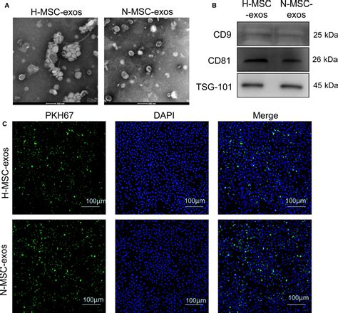 Exosomal Hmgb1 Derived From Hypoxia‐conditioned Bone Marrow Mesenchymal Stem Cells Increases