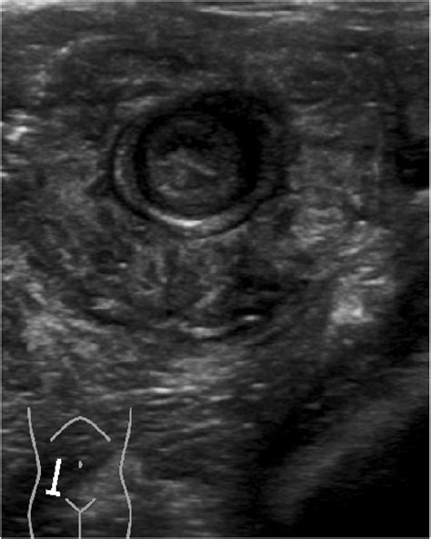 Us Showing Typical Target Sign Download Scientific Diagram
