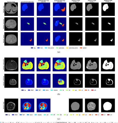 Figure 2 From Training Cnn Classifiers For Semantic Segmentation Using Partially Annotated