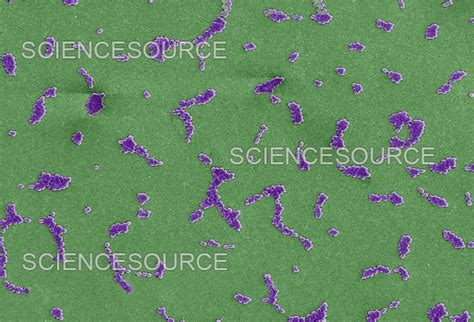 Acinetobacter Baumannii Bacteria Sem Stock Image Science Source Images