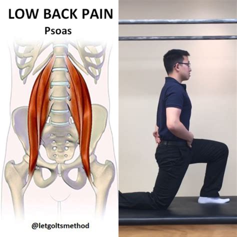 What Causes Psoas Tendonitis Iliopsoas Syndrome Stretches Exercises