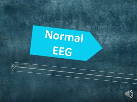 Eeg Basic To Practice 2 Pptx