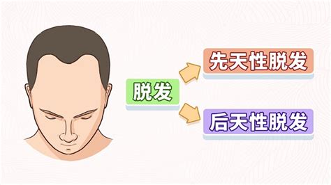 中华医学会 科普图文 脱发原因大盘点来看看你属于哪一种