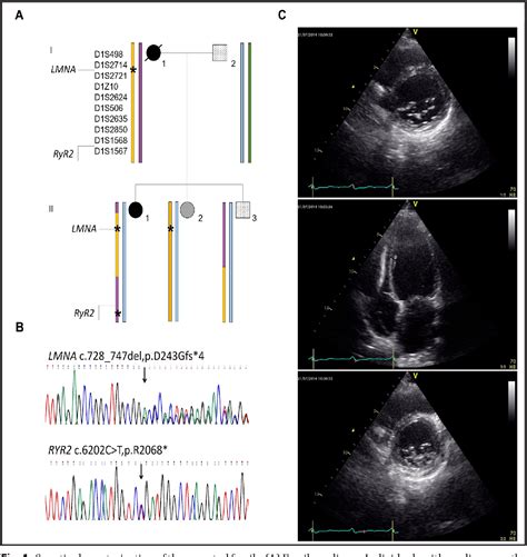 Figure 1 From Functional Characterization Of A Novel Truncating Mutation In Lamin Ac Gene In A