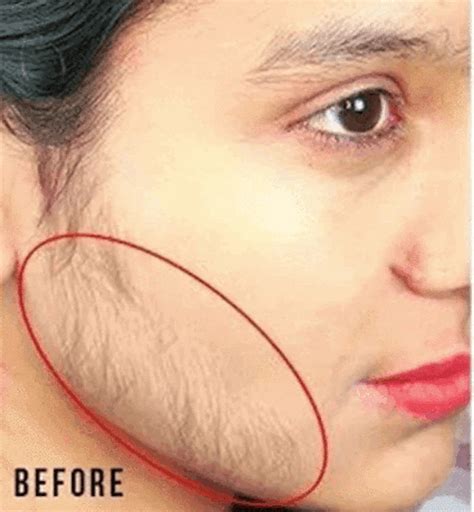 Buy Facial Hair Tea For Facial Hair Removal Smooth Skin And Hormonal Balance