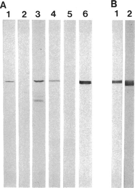 Identification Of Rat Brain Dynamin L Specific Antibody A Sea Urchin Download Scientific